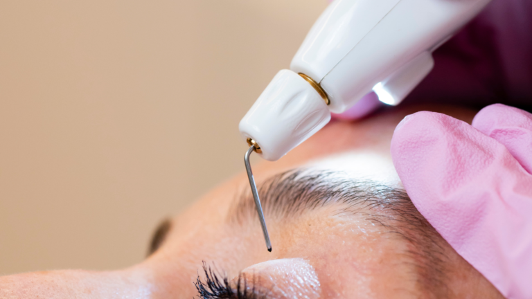 Plasma Pen, en qué consiste el tratameito |Dra.Barriga